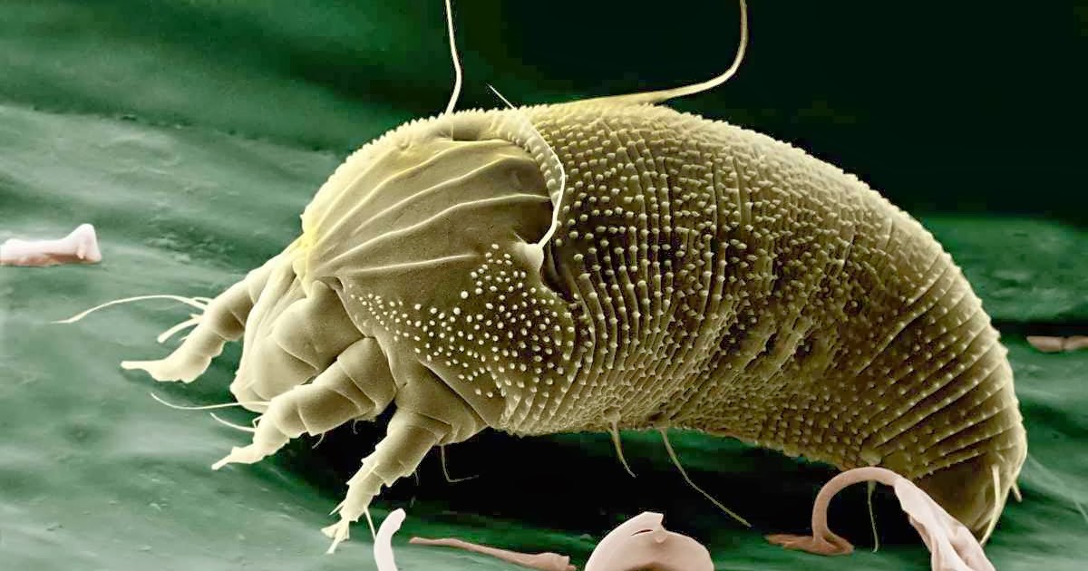 Gale : symptômes, traitement, prévention et conseils pratiques | Agence ...